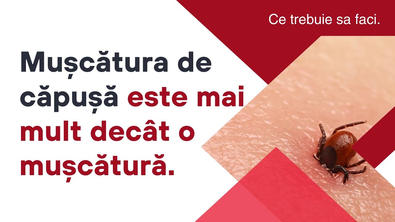 Muscatura de capusa este mai mult decat o muscatura! Ce trebuie sa faci ...