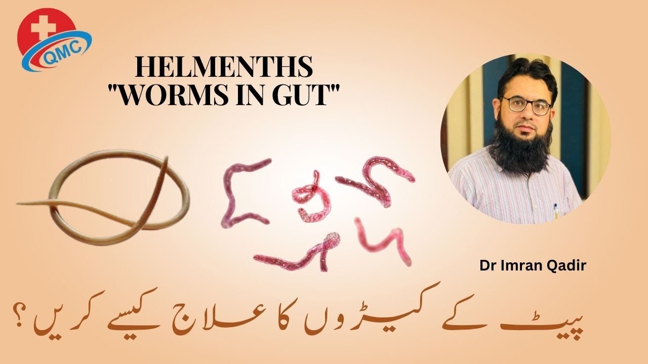 helmenths worms in gut پیٹ کے کیڑوں کا علاج کیسے کریں Dr imran Qadir ...