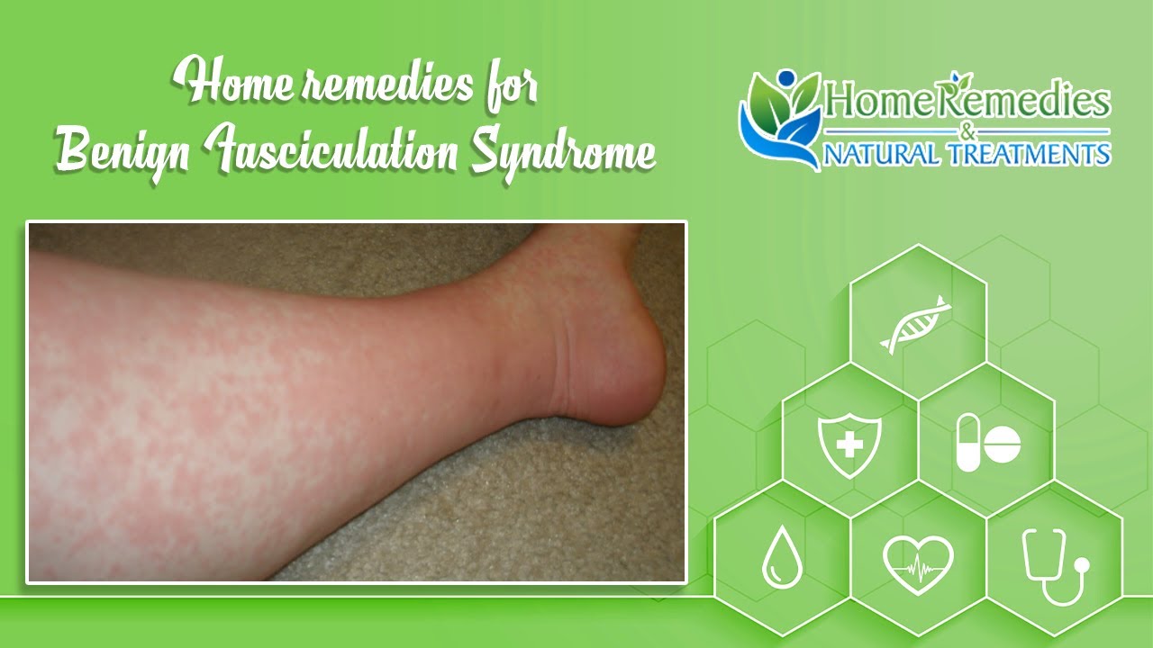 Home remedy & natural treatments for benign fasciculation syndrome ...