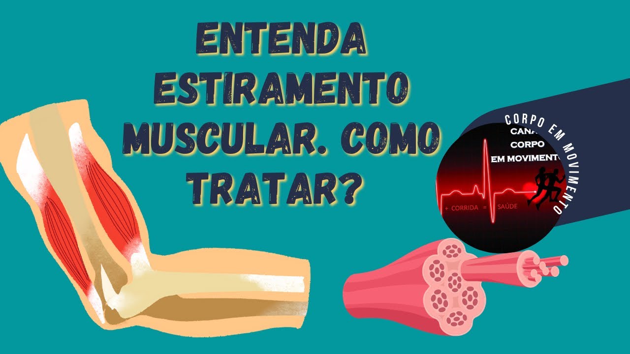 Estiramento Muscular. Você sabe como Tratar? - YouTube