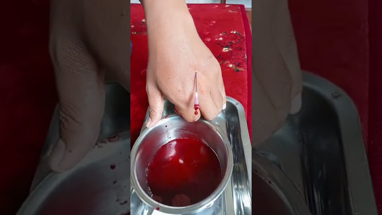 Rawatan Al-Fashdu 018-9824473 - YouTube