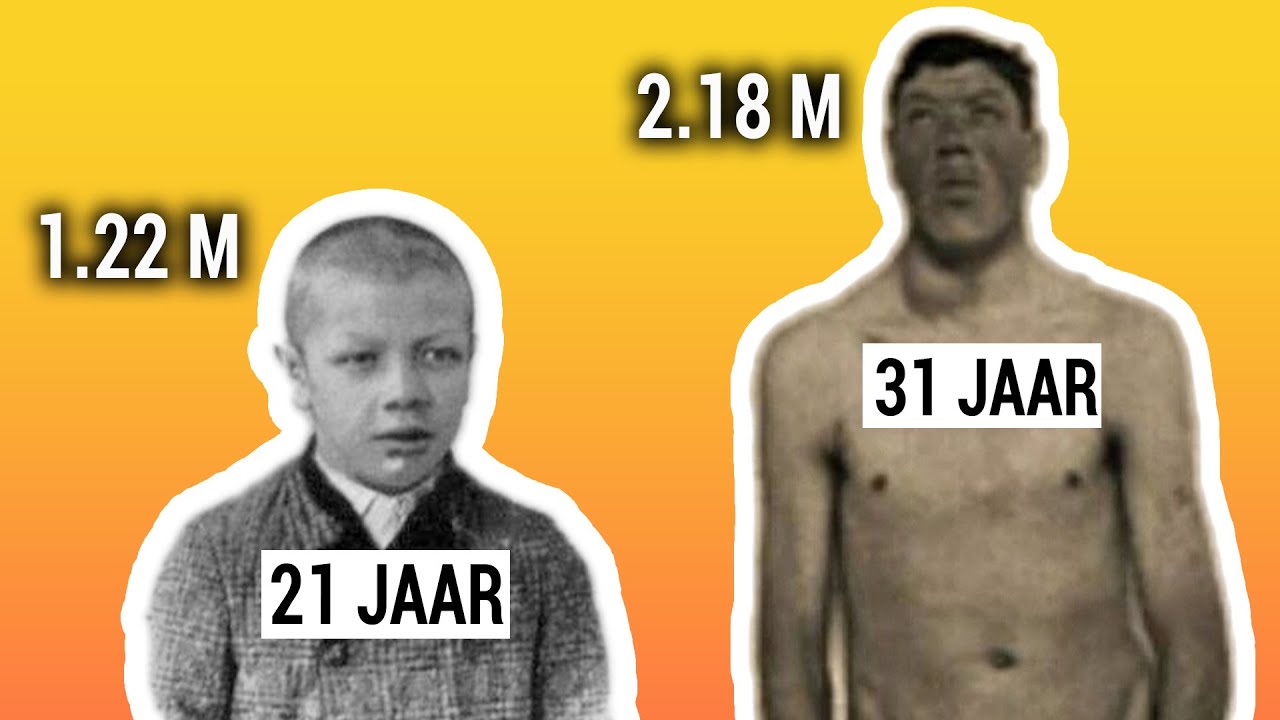 Deze Dwerg VERDUBBELDE Zijn Lengte in 10 Jaar! 📏 - YouTube