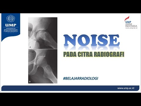 BELAJAR RADIOLOGI #12 - NOISE PADA CITRA RADIOGRAFI #radiologi # ...