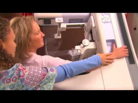 Hologic's 3D mammography system becomes first to get FDA approval xvid ...