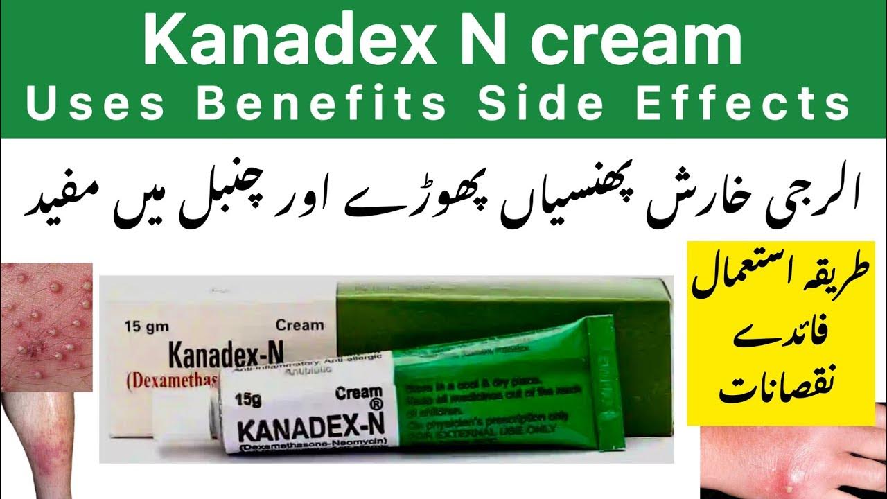 Kanadex N Cream Used For | Kanadex N Cream Side Effects | Kanadex N ...