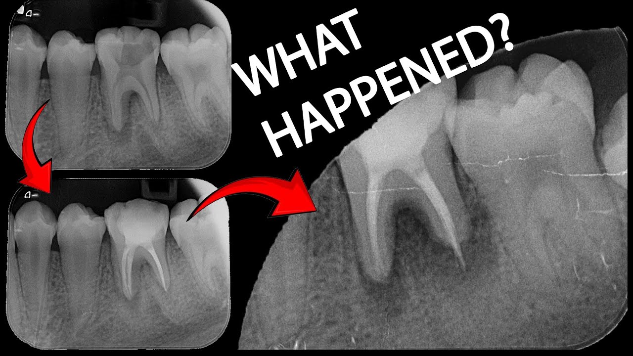 RCT failed after 10 months - New educational case with Arabic voice ...