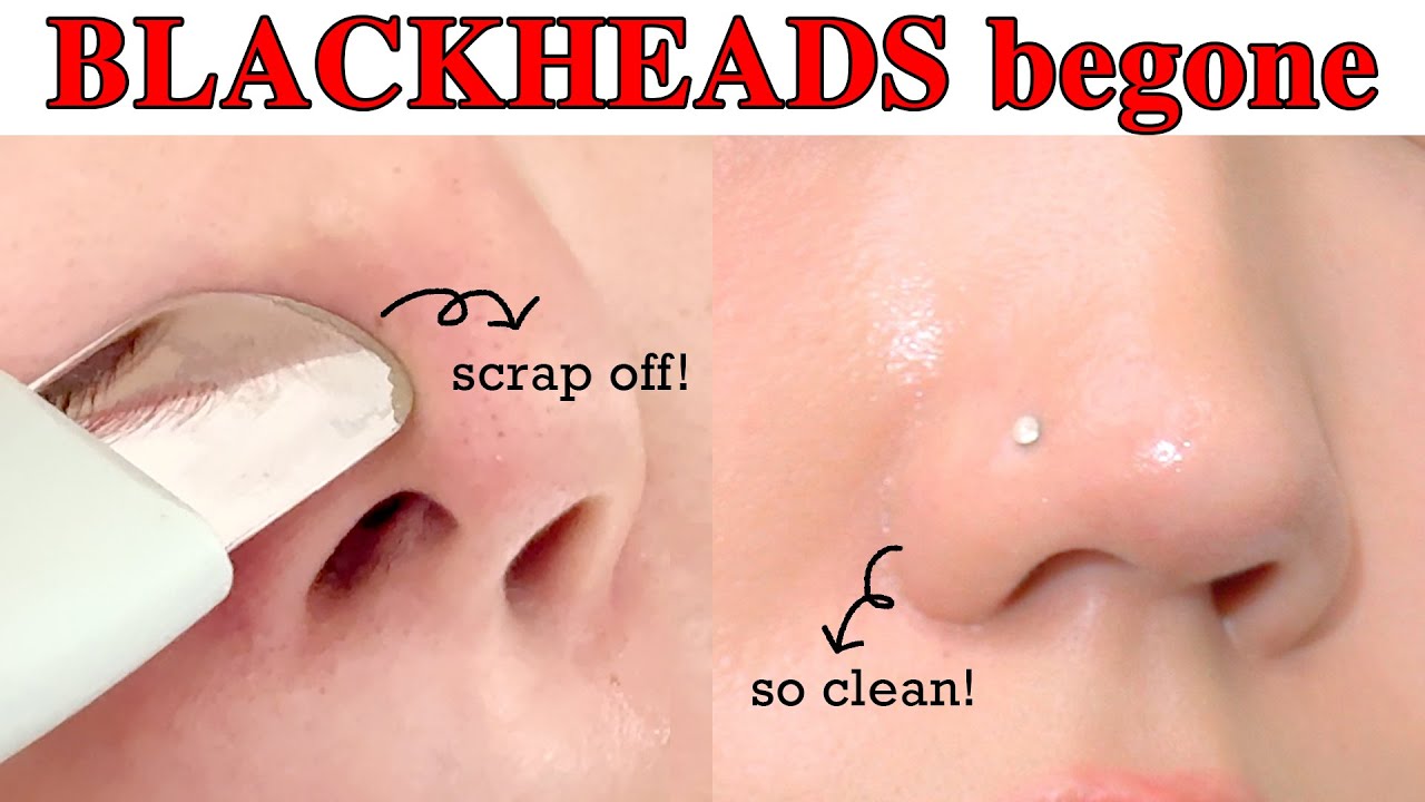How do I manage my nose so smooth and clean? So SIMPLE Blackhead care 🔥 ...
