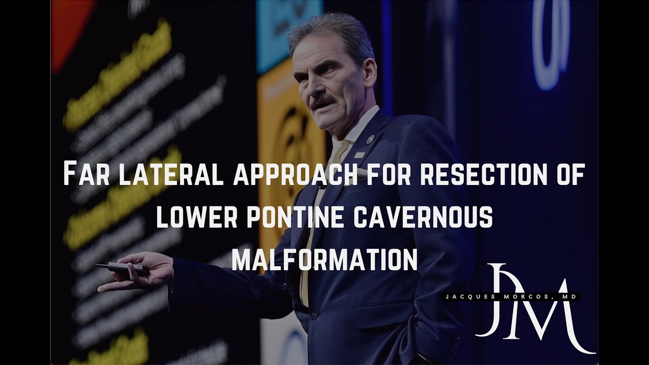 Far Lateral Approach for Resection of Lower Pontine Cavernous ...