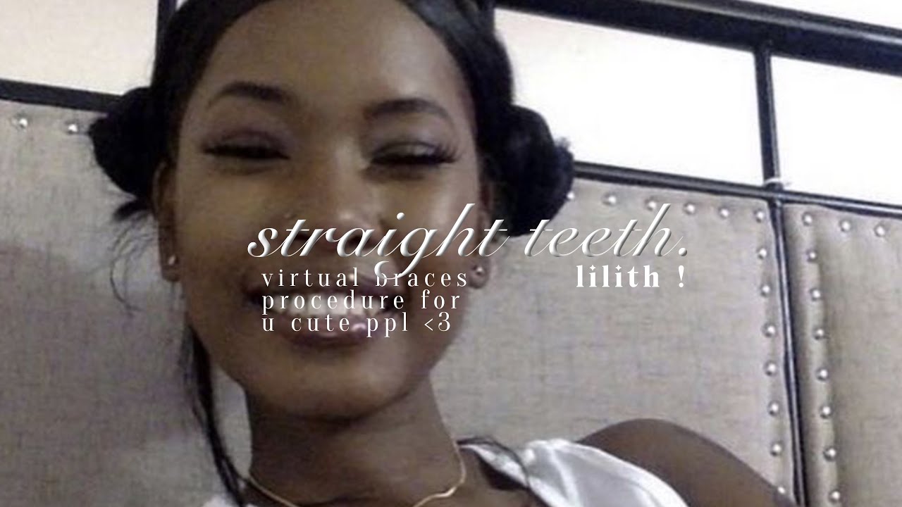 straight teeth 🦷 ☆!! extreme virtual braces procedure - YouTube