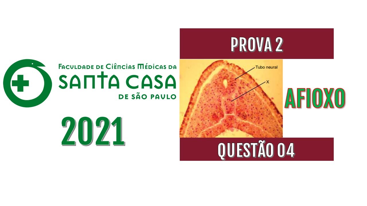 (FMSCSP-2021)A imagem ilustra um corte transversal do anfioxo, com ...