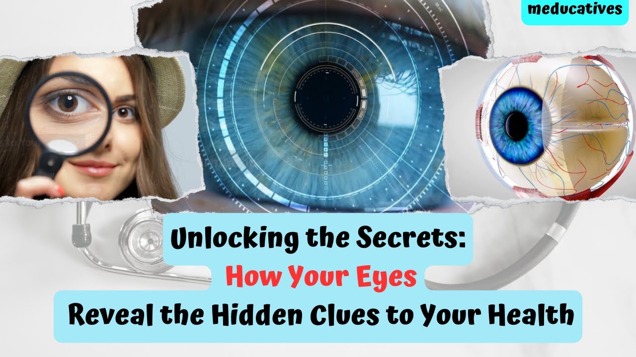 Unlocking the Secrets: How Your Eyes Reveal the Hidden Clues to Your ...