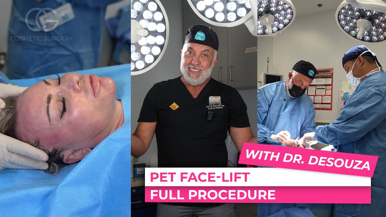 Full PET: Face - Lift Surgery / CG Cosmetic Surgery - YouTube
