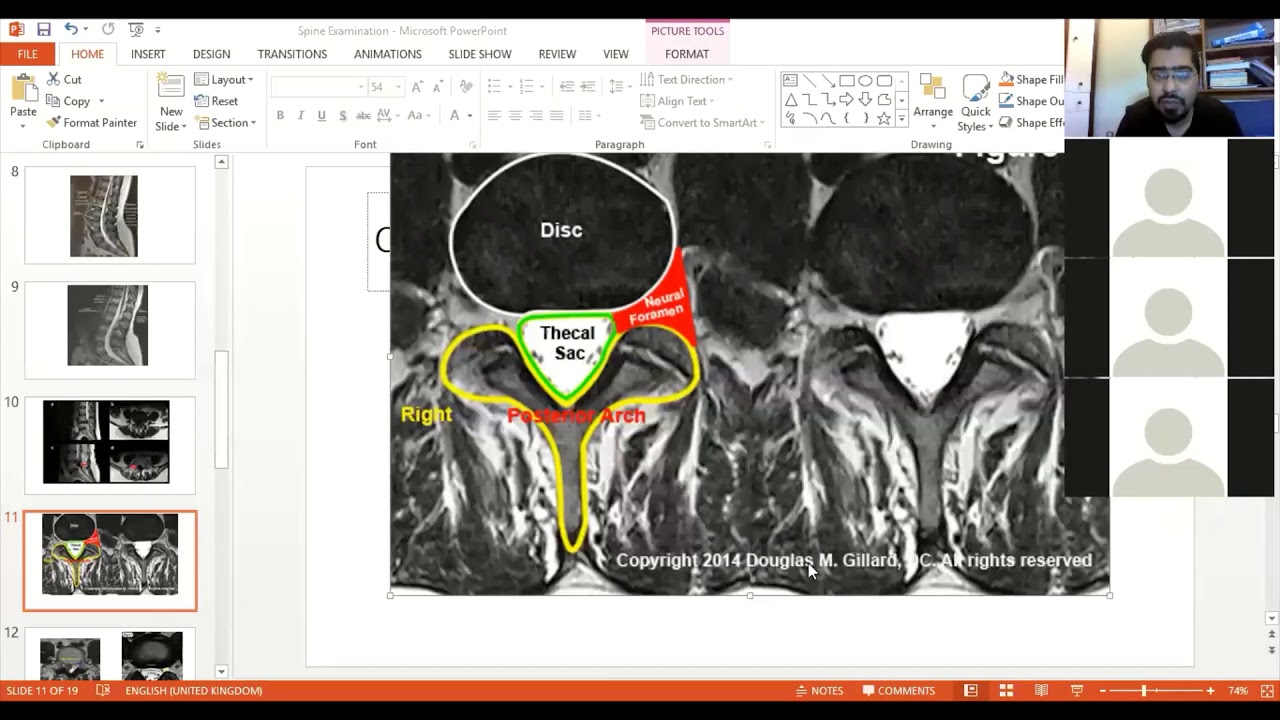 How to read MRI Lumbosacral spine for Orthopedic Surgeon Part 1 - YouTube