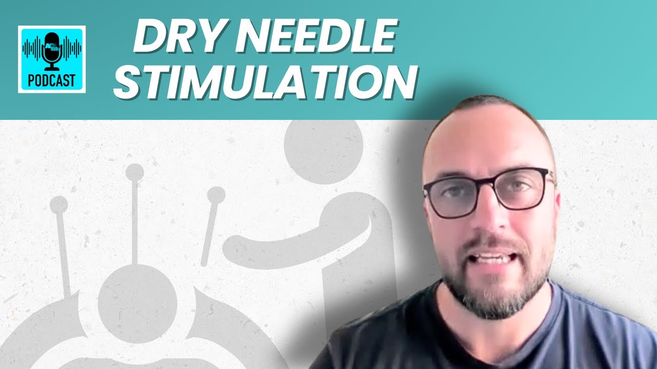 Dry Needle Stimulation - YouTube