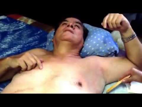 Las salvajadas de mi hermana al depilarme las axilas. Perdí 2 litros de sangre, me transfundieron.