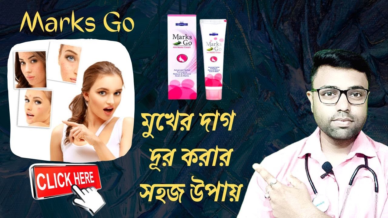 Hapdco Marks Go Antimarks Cream ।। Best Antimark cream ।। Review In ...