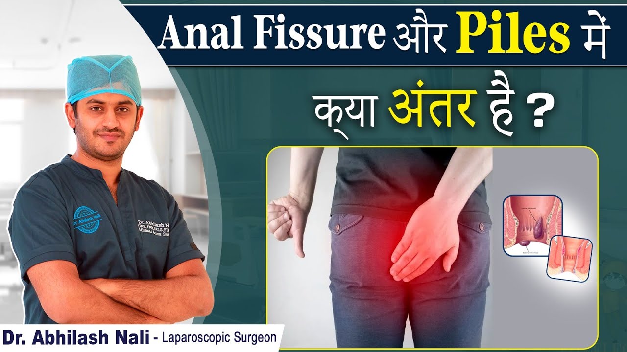 Difference Between Piles Fissure and Fistula | Home Remedies for Piles ...
