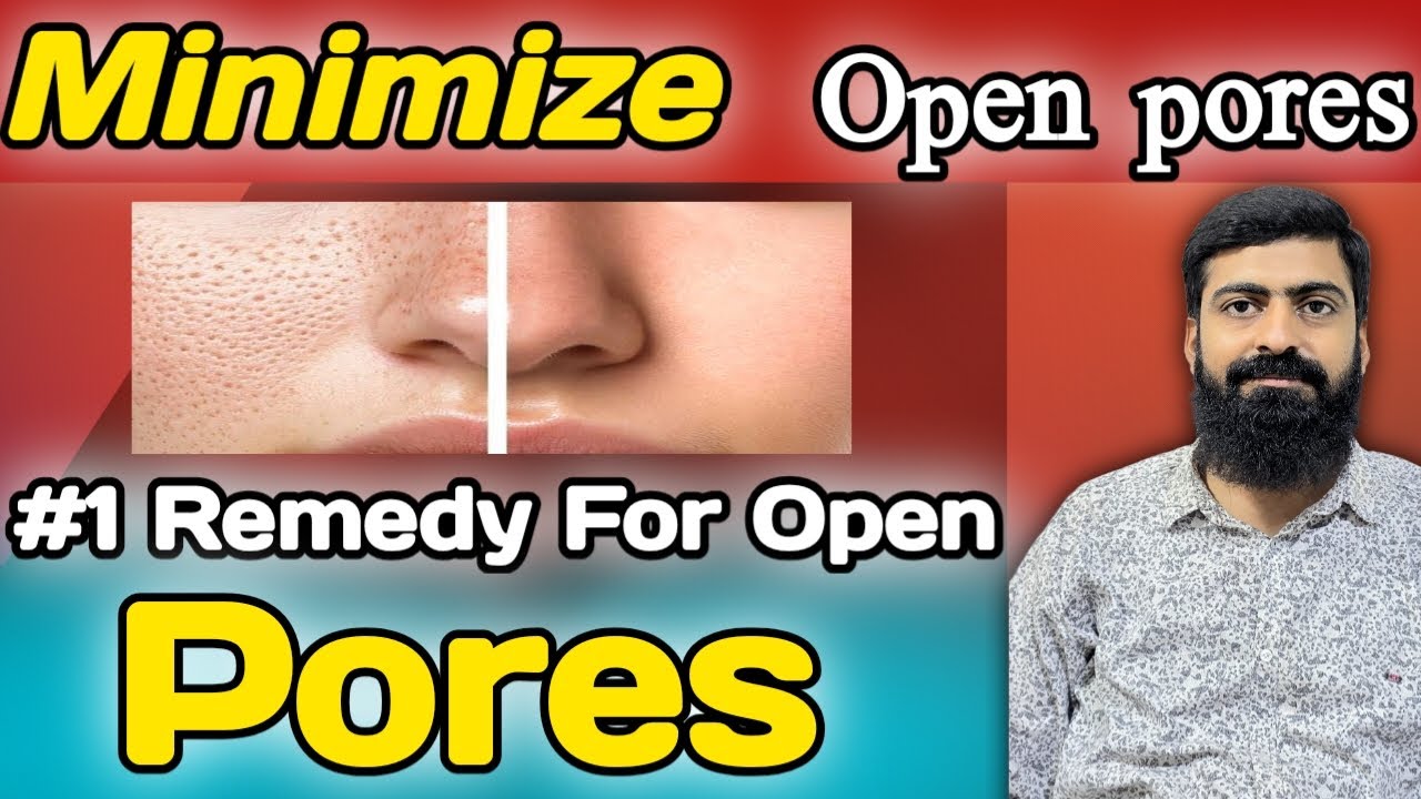 Secrets to Clear & Glowing Skin with Home Remedies Open Pores, Large ...