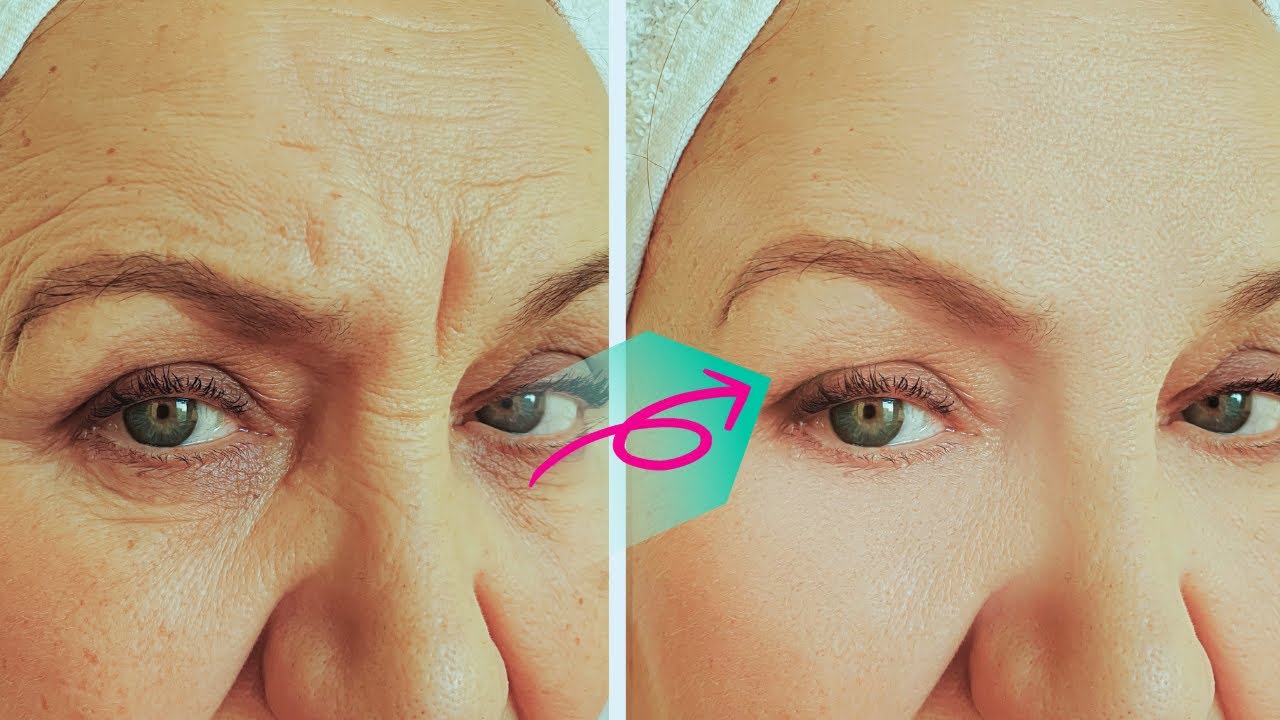 40 Years Old Look 25 No Wrinkles Only Young Skin | Get Wrinkle free ...