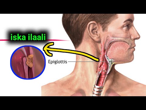 Sidaan ha sameeynin cuntada markaa cuneeyso ama Biyaha aa cabeeyso hadii kale waxaa dhacaayo in aaa