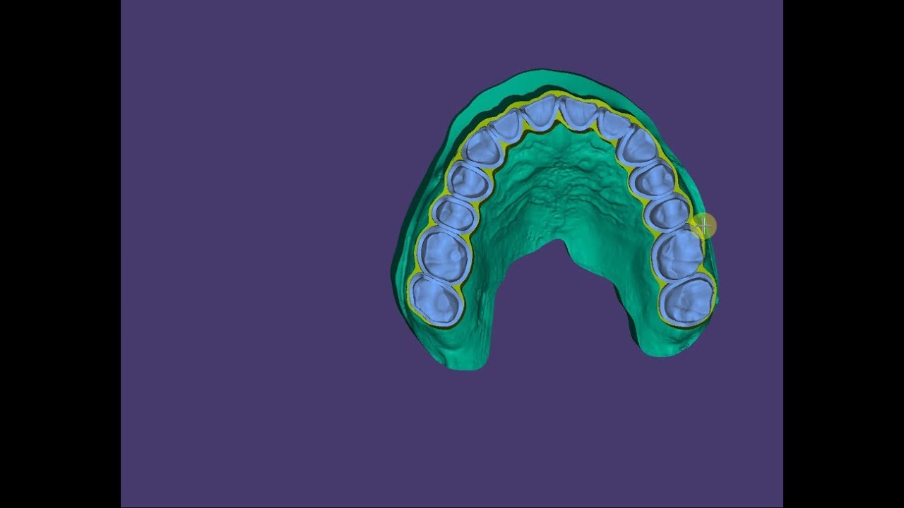 exocad Tutorial: Digital Prep Model - YouTube