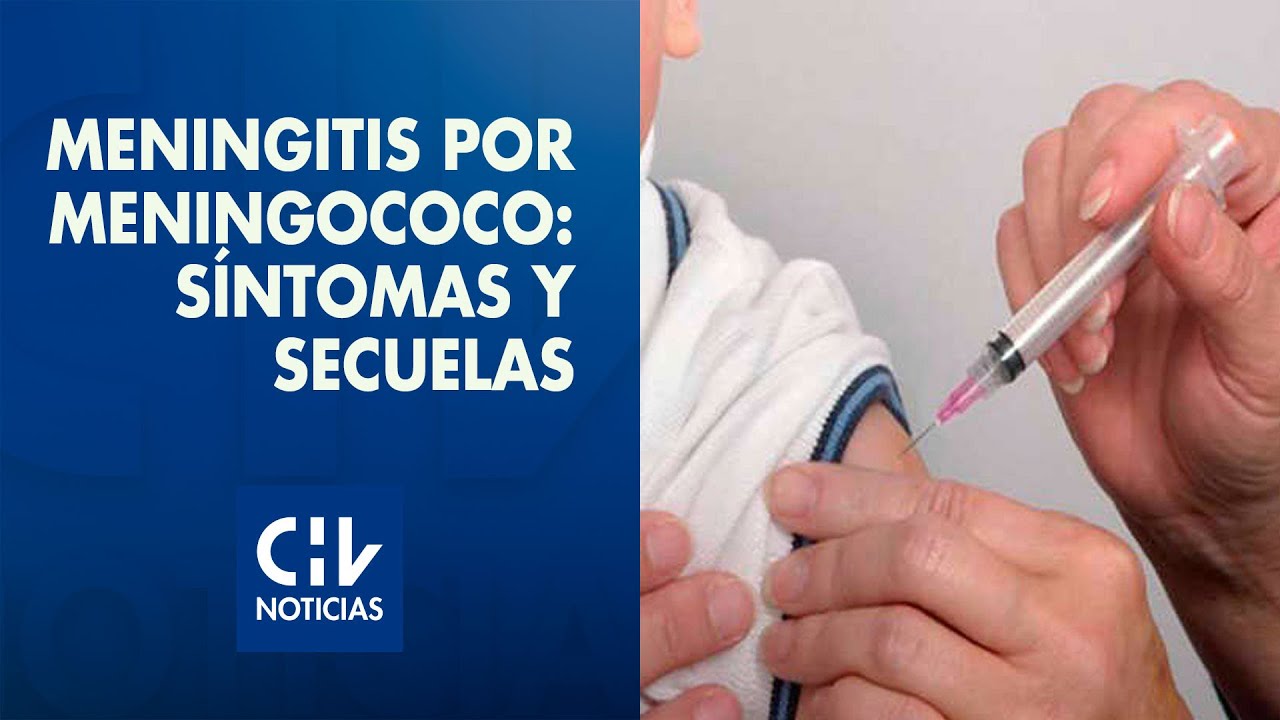 Meningitis por meningococo: Los síntomas y las secuelas que deja la ...