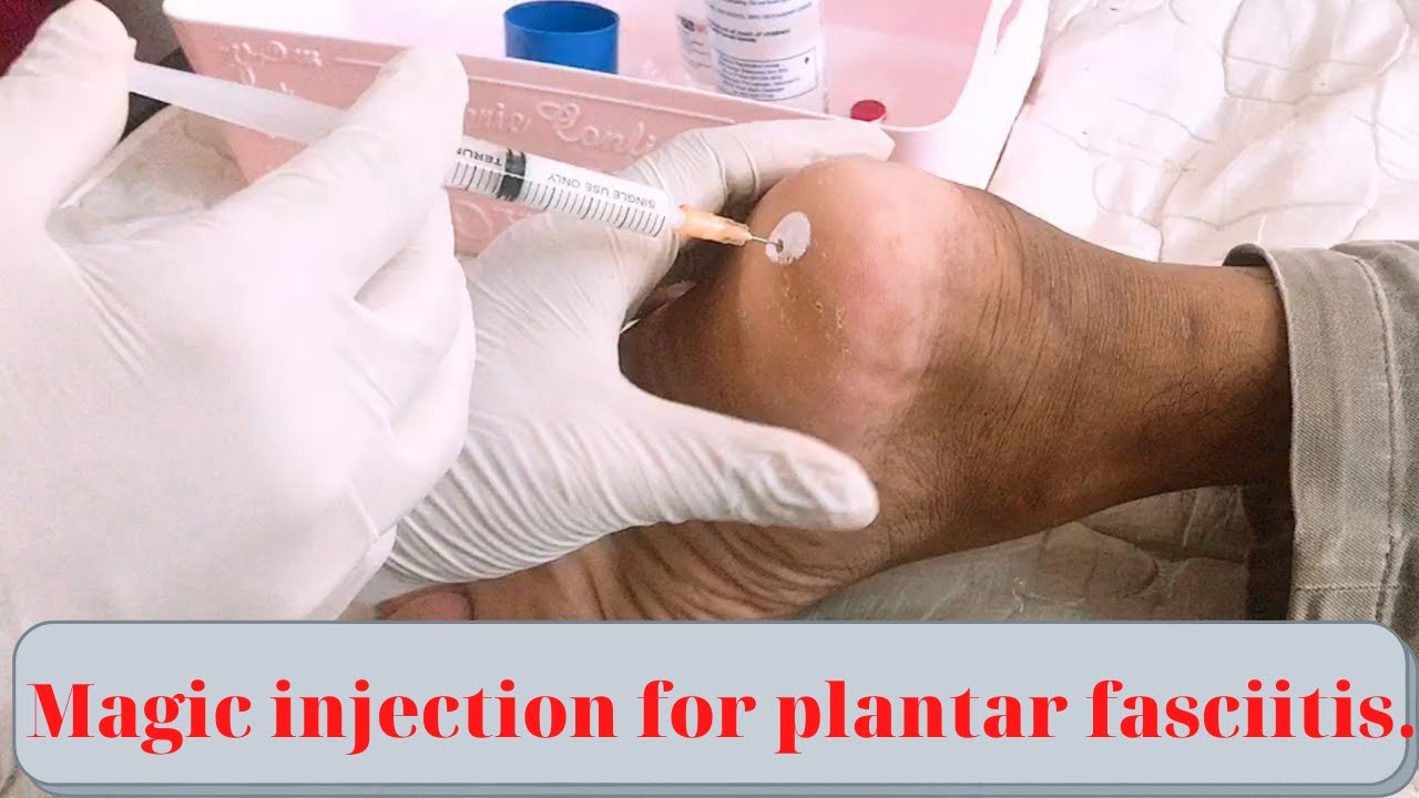 পায়ের গোড়ালির ব্যাথায় জাদুকরী ইন্জেকশন।Magic injection for Heel pain ...