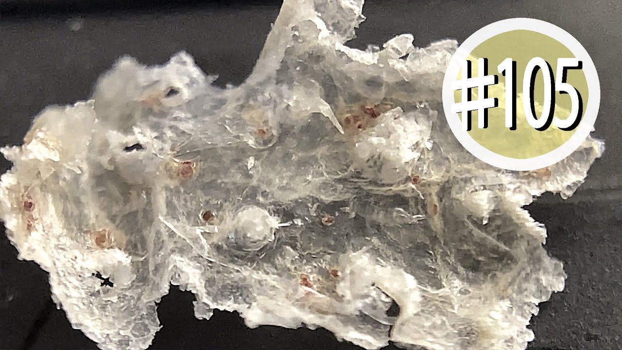 No.105 にゅっと出る頭皮の皮脂詰まり / Sebum clogged scalp/ Cuero cabelludo obstruido ...