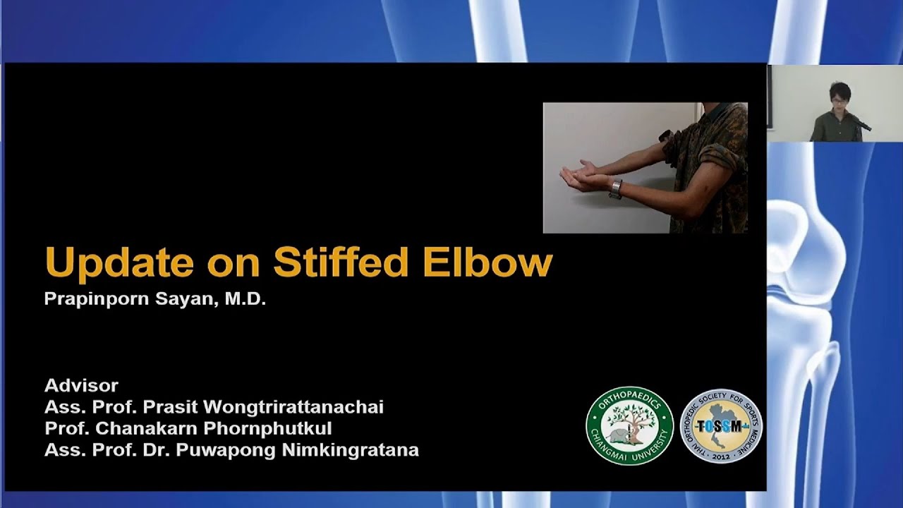 Update on stiffed elbow - YouTube