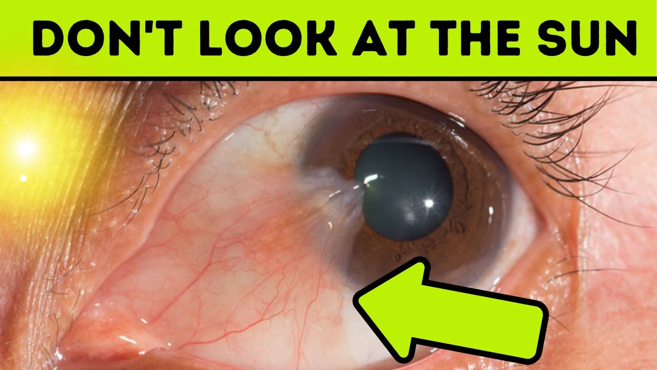 This Happens After 3 Hours of Looking at the Sun - YouTube