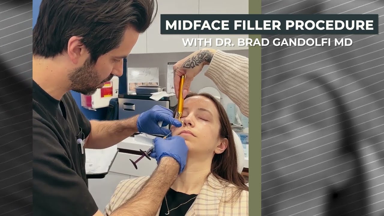 Midface Rejuvenation Filler Procedure with Top NYC Plastic Surgeon Dr ...