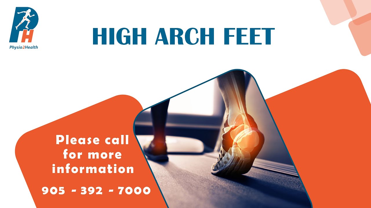 Physio2Health - High Arch Feet (Cavus Foot) And Physiotherapy in ...