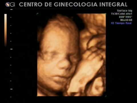 Video ecografía 4D - 27 semanas - YouTube