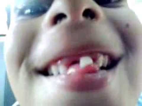 The shaking teeth- just for fun - YouTube