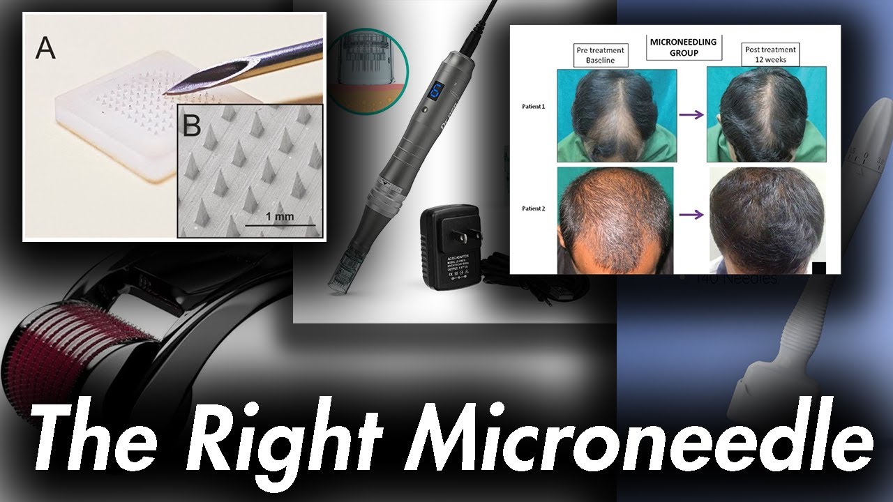 Derma Roller vs. Derma Pen: Which is the best for microneedling? # ...