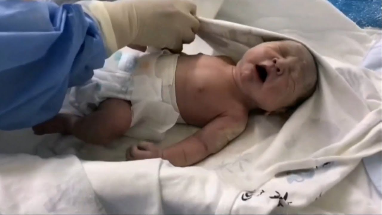 Childbirth - Normal Delivery| LIVE BIRTH VLOG | C-SECTION DELIVERY IN ...