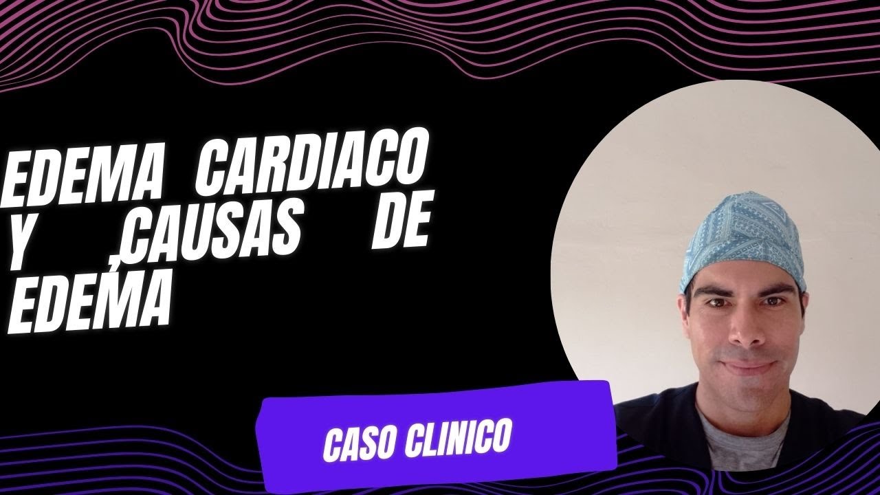 EDEMA CARDIACO Y CAUSAS DE EDEMA - YouTube