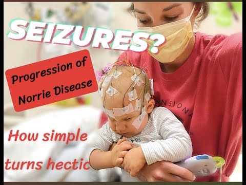 NORRIE DISEASE & SEIZURES: a busy week turns hectic. Simple turns ...