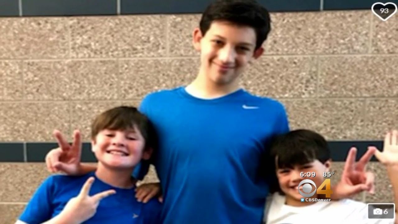 Gigantism Symptoms In Children