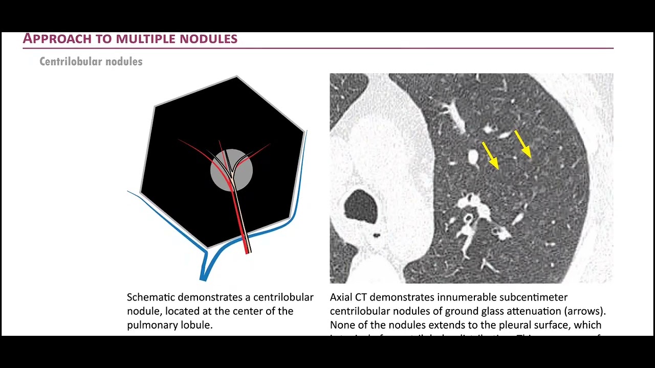 CORE RADIOLOGY BY JACOB MENDAL PDF - YouTube