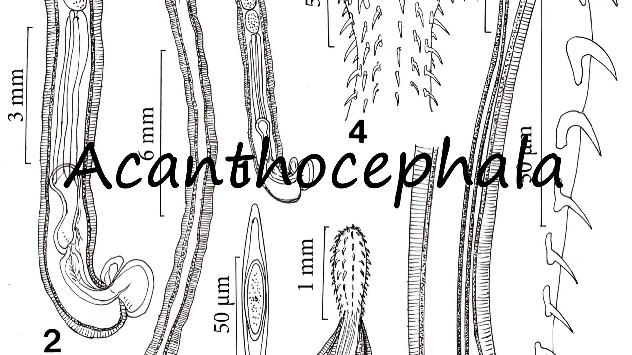 How to Pronounce Acanthocephala? - YouTube