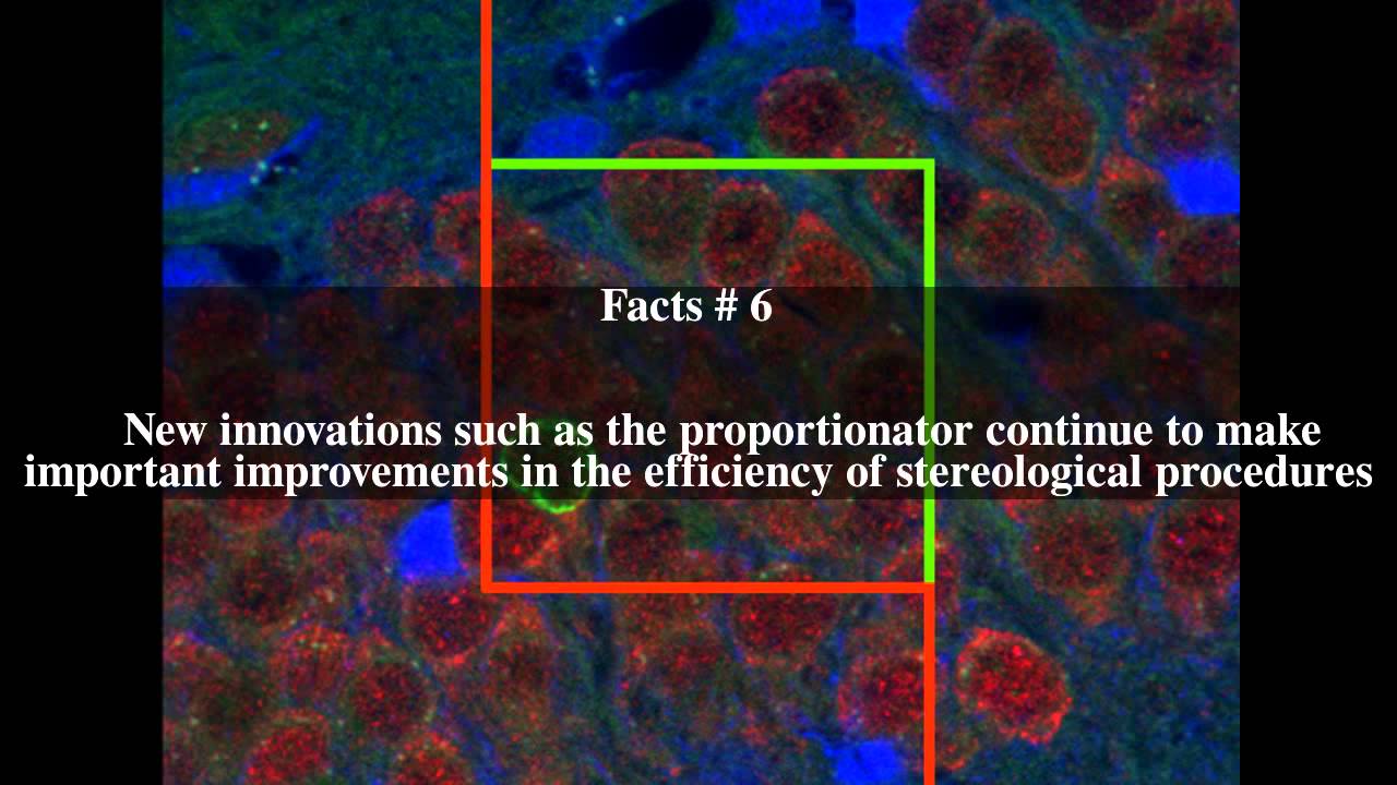 Stereology Top # 9 Facts - YouTube