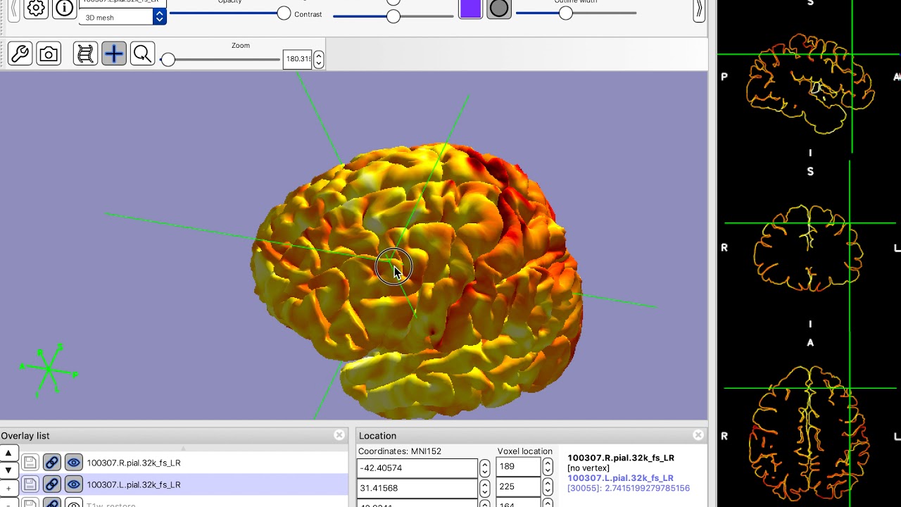 FSLeyes: selecting vertices in 3D - YouTube