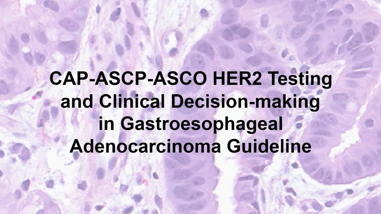 Cap Ascp Asco Her2 Testing And Clinical Decision Making In