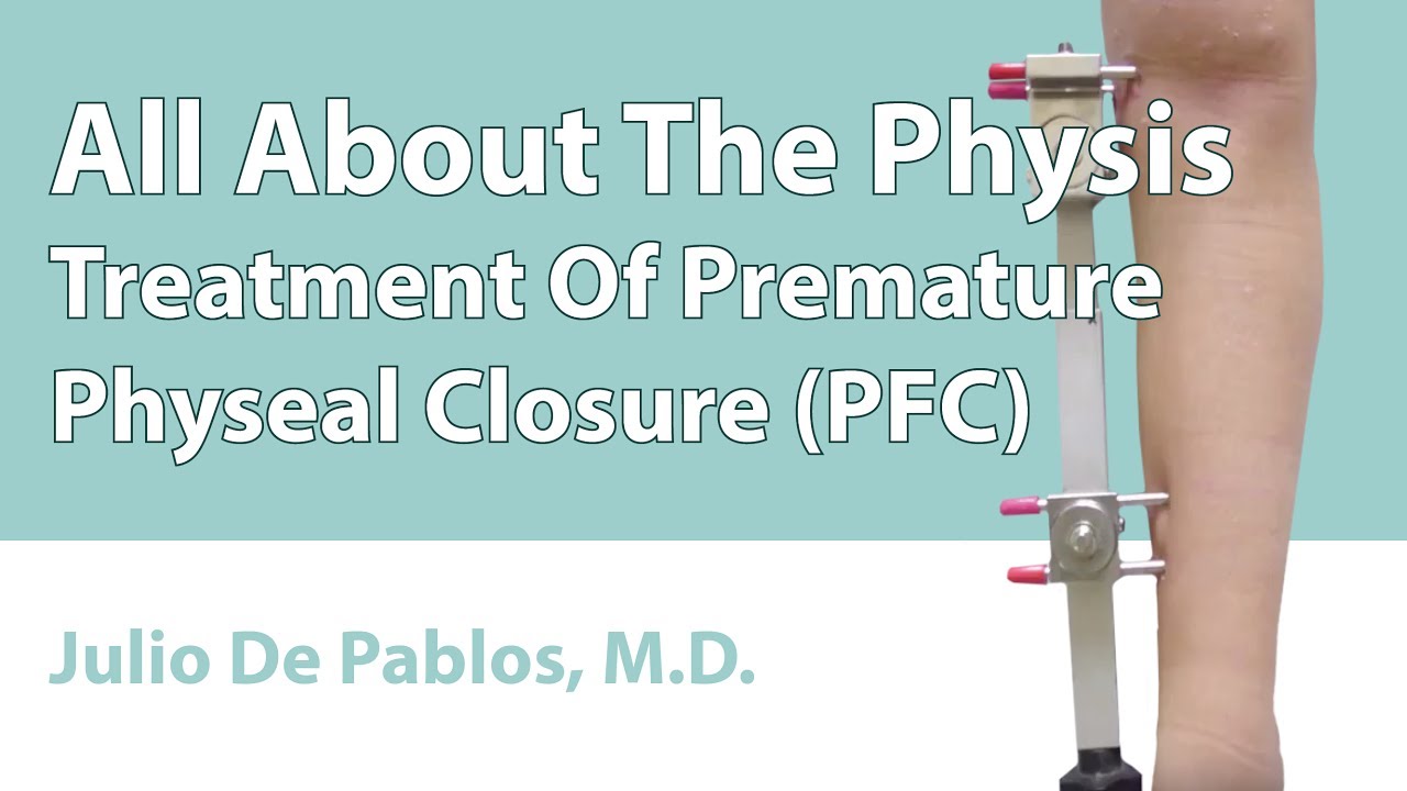 Treatment Of Premature Physeal Closure (PFC) - YouTube