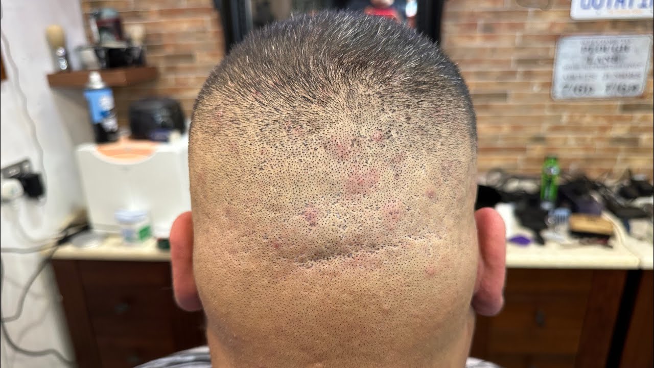 LIVE BARBER TUTORIAL. THIS IS HOW I SKIN FADE WITH A GRADE 4 ON TOP ...