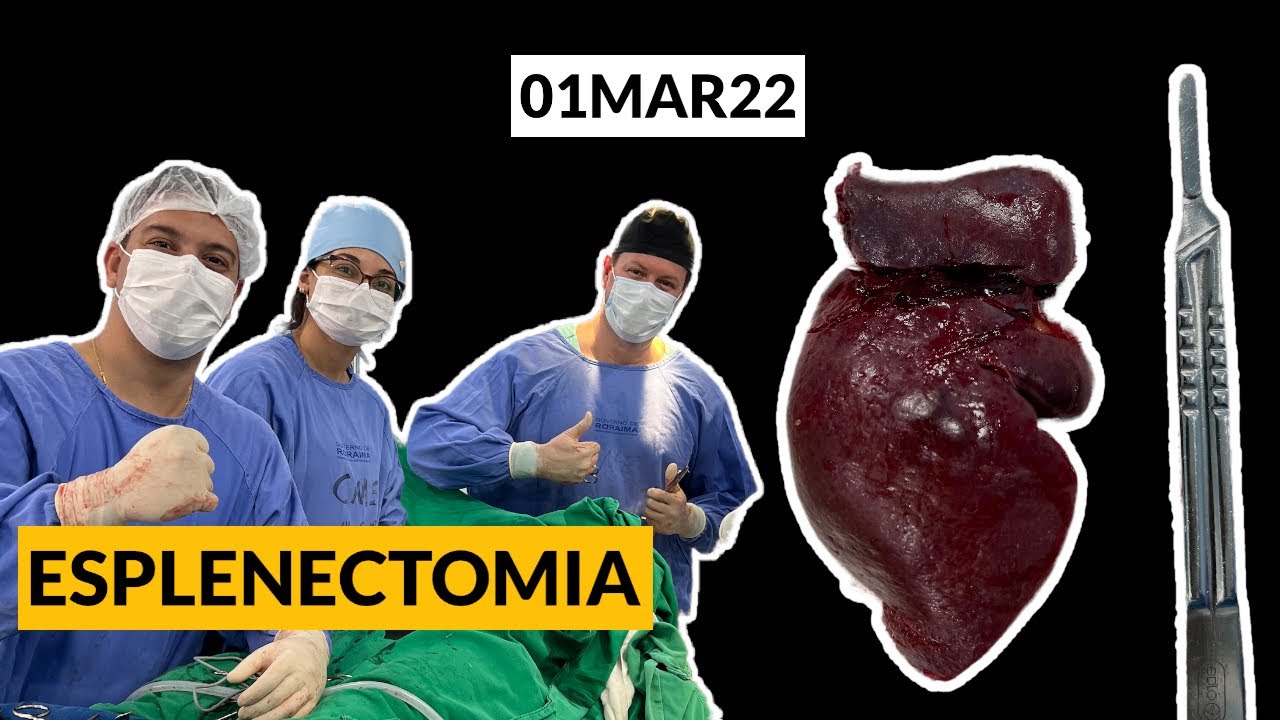 Trauma Esplênico 4K • 4K Splenic Trauma - DR. LUCAS DUARTE - YouTube