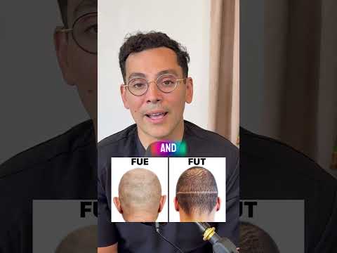 The Real Difference Between FUE and FUT Hair Transplants – Doctor Explains