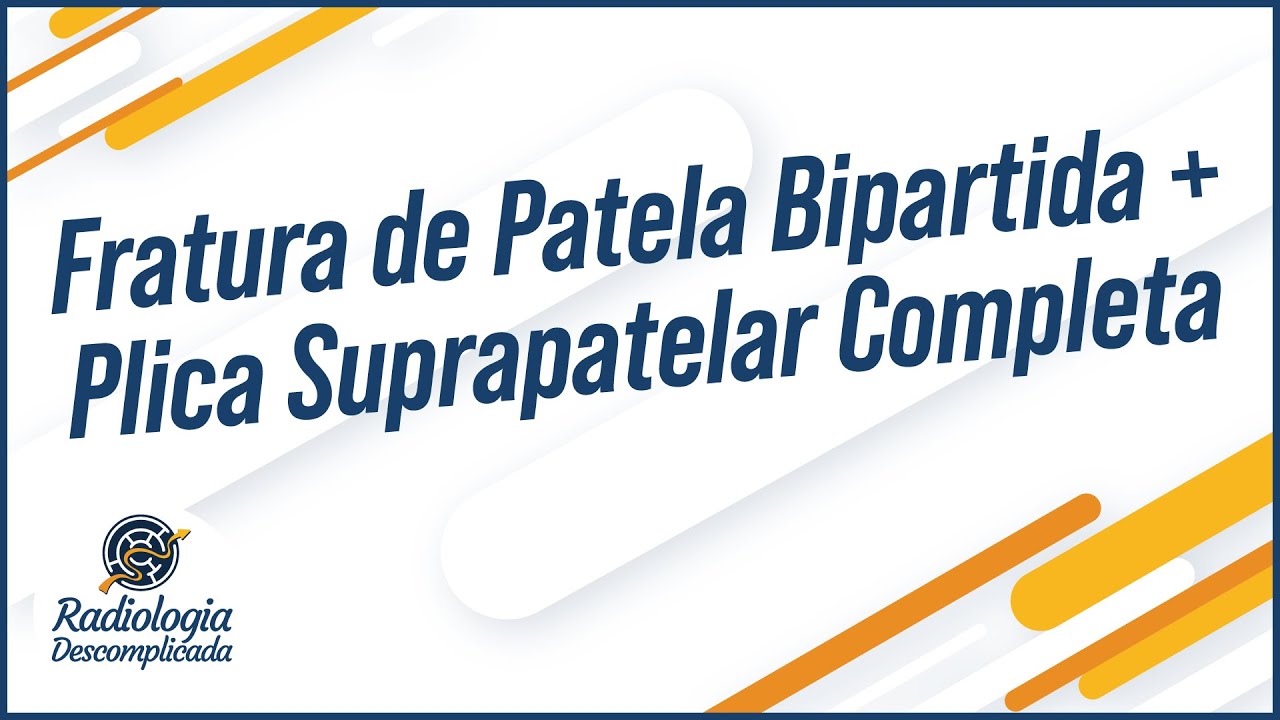 MSKases #03 - Fratura Patela Bipartida + Plica Suprapatelar Completa ...