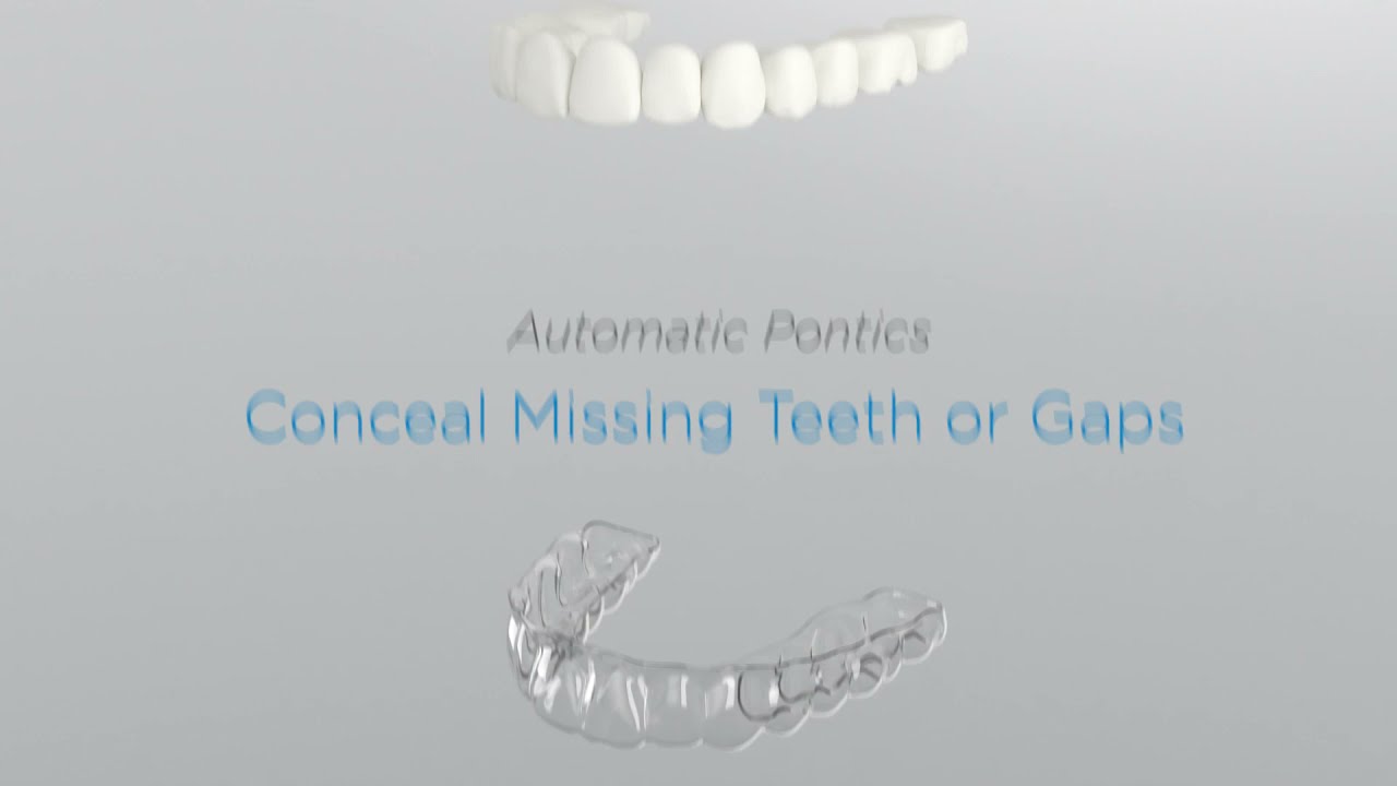 SureSmile Clear Aligner Software 7.2 - Clinician Benefits - YouTube